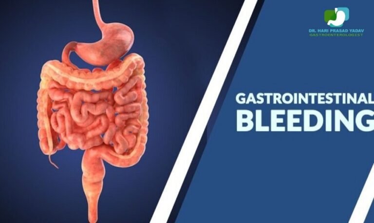 Gastrointestinal Bleeding Doctor in Indore by Dr Hari Prasad Yadav